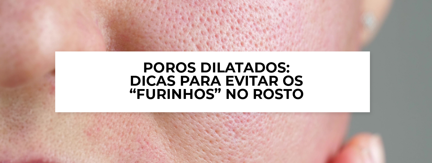 Poros dilatados - dicas para evitar os “furinhos” no rosto - Blog Ada Tina