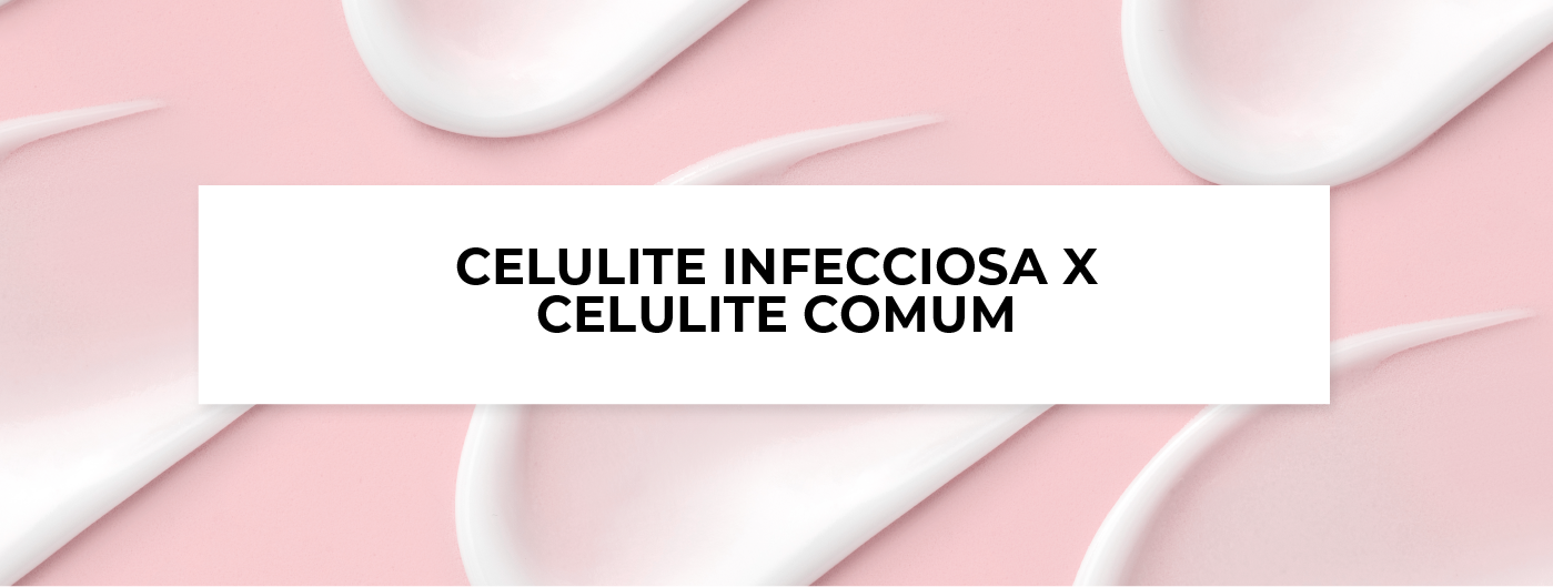 Diferença da celulite infecciosa e da celulite comum - Blog Ada Tina